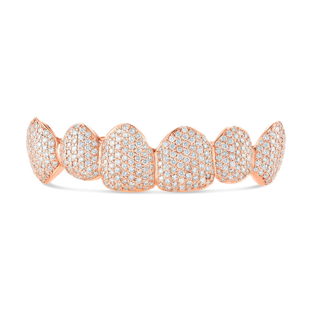 ICED OUT GOLD Custom GRILLZ – SHYNE JEWELERS
